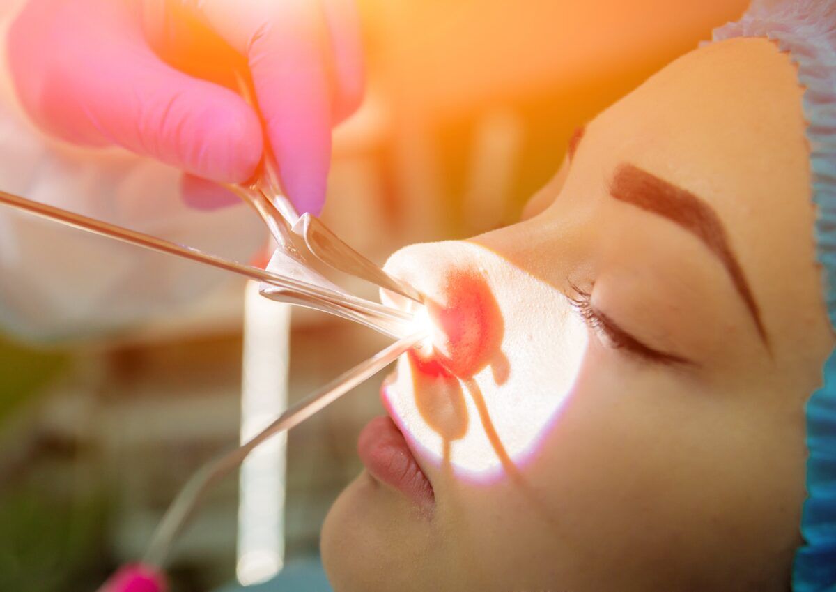 The Benefits and Risks of FESS: What to Consider Before Surgery ...