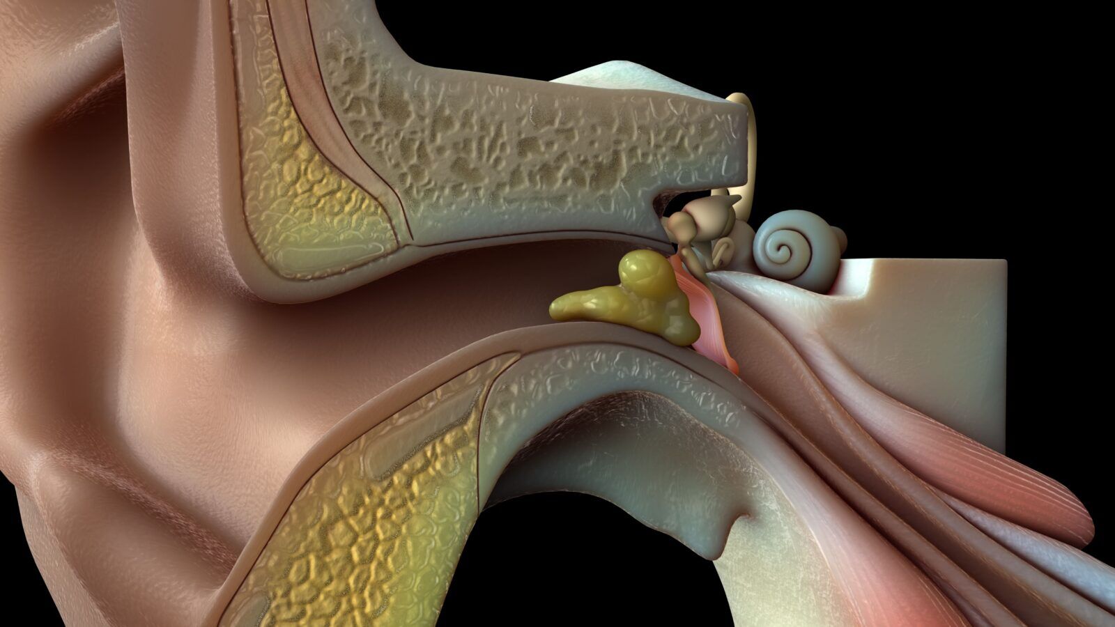 Safely Removing Ear Wax: Expert Advice from an ENT Doctor | Annapolis ...